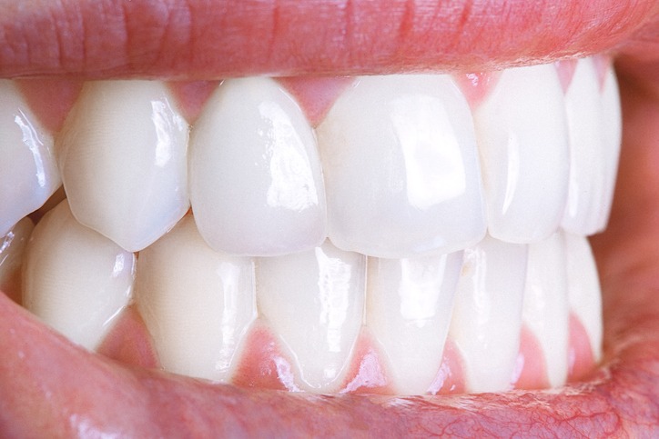 How to get whiter teeth? - Optimistic Mommy