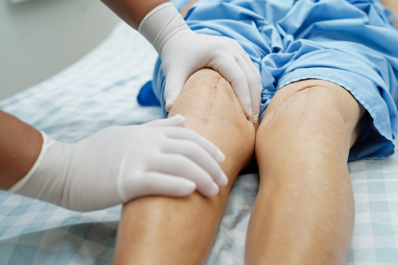 Deciding On Knee Replacement: Signs It's Time To Consider Surgery ...